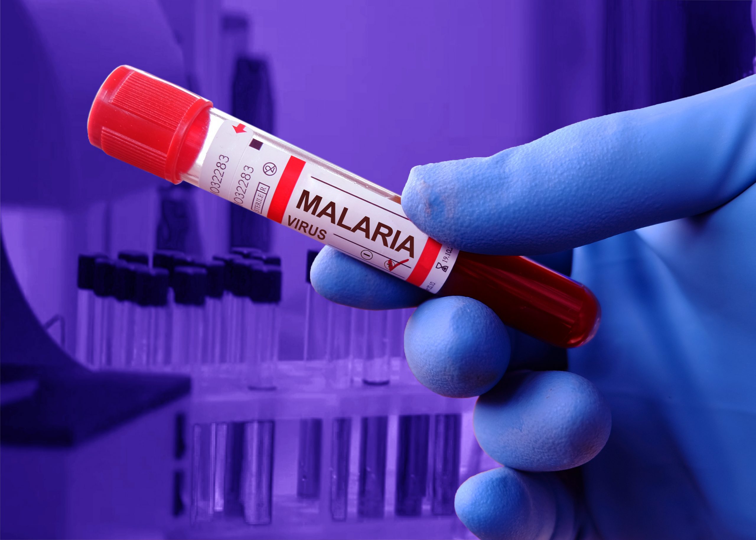 Tout savoir sur le paludisme en Afrique - Biogaran Afrique