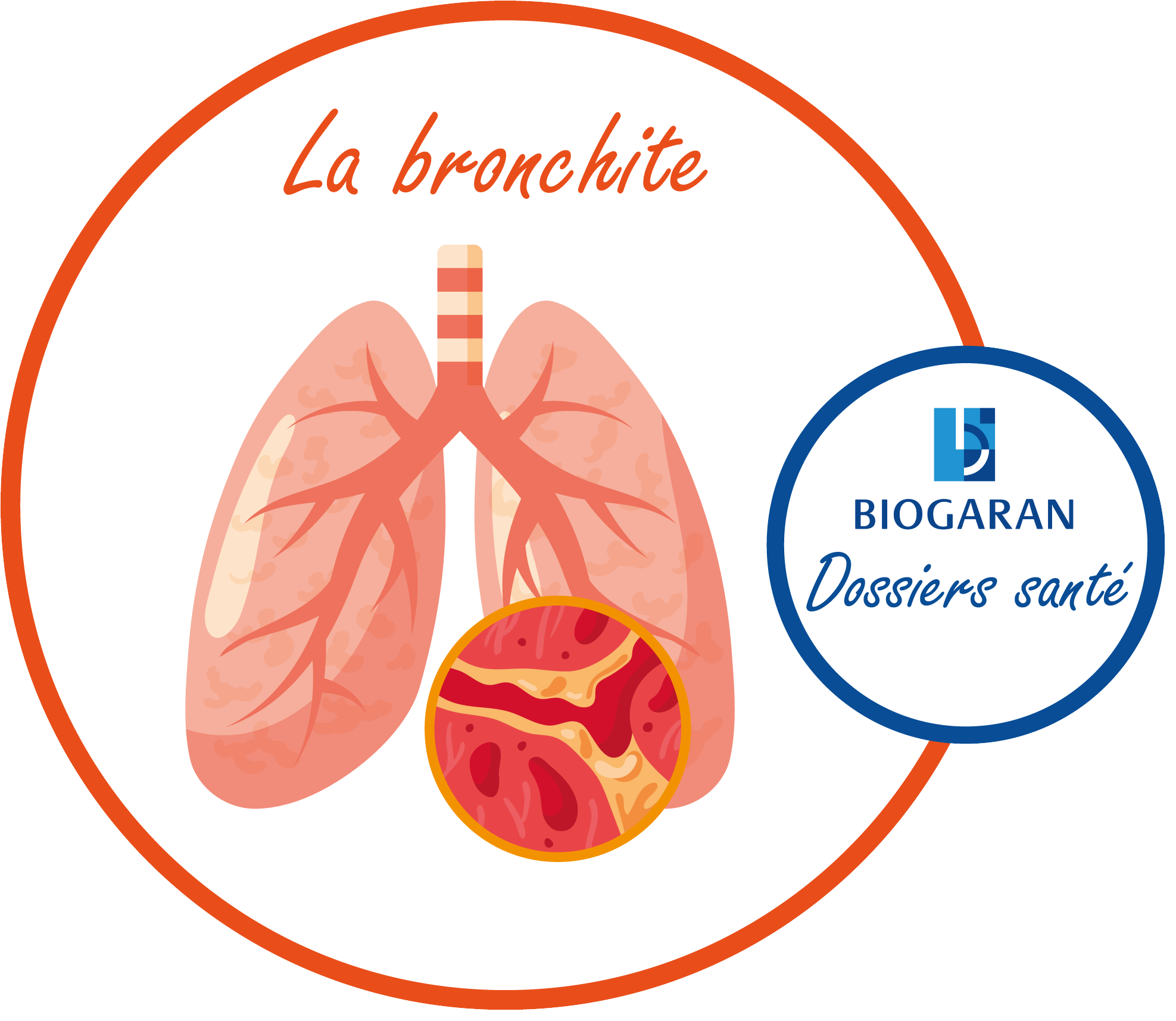 Les infections respiratoires #1 : la bronchite - Biogaran Afrique
